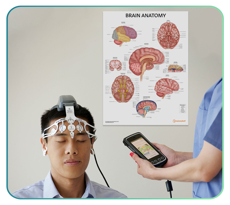 Brain Anatomy Posters – AnatomyStuff