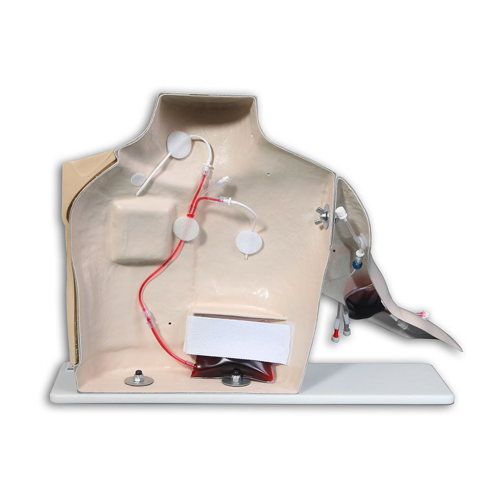 Chester Chest with Advanced Arm Port Access | Vascular VATA – AnatomyStuff
