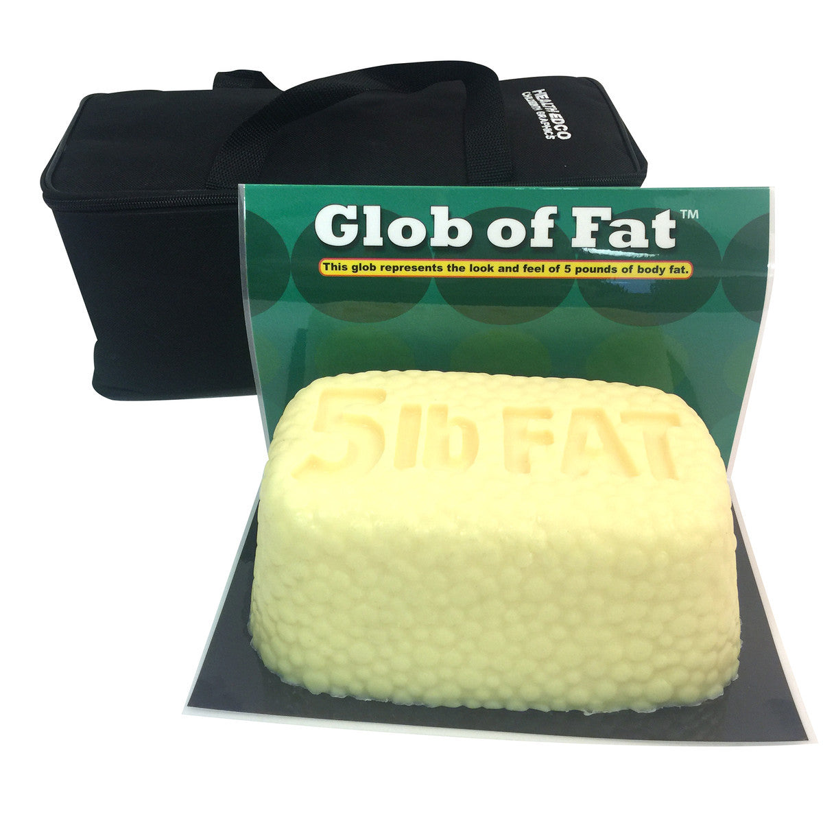 Glob of Fat Model (5 lb) 26039 | Five Pound Fat Glob | Health Edco ...