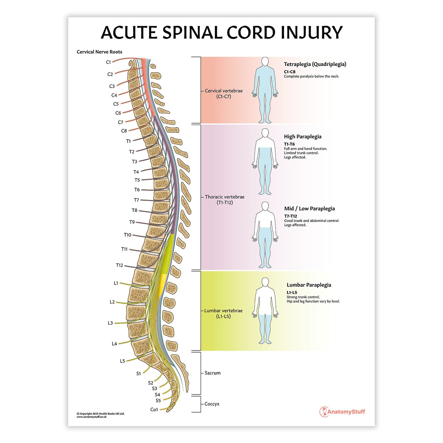 Acute Spinal Cord Injury Poster | SCI Chart – AnatomyStuff