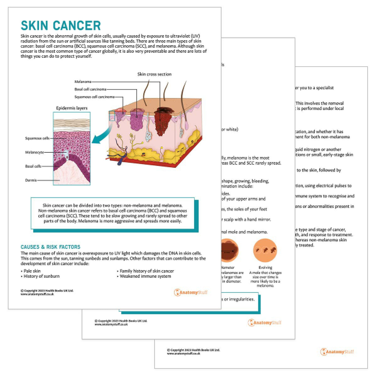 Patient Education Handouts | PDF Download – AnatomyStuff