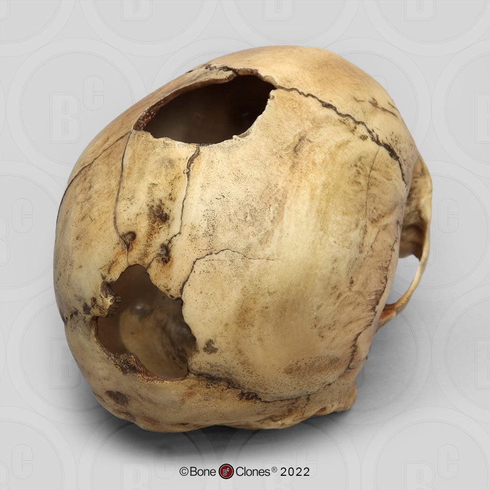 Bone Clones Forensic Trauma Skulls | Osteology Models | AnatomyStuff