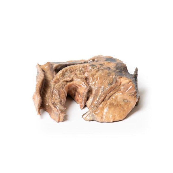 Inhaled Foreign Body Trachea 3D Printed Anatomy Model | Anatomical ...