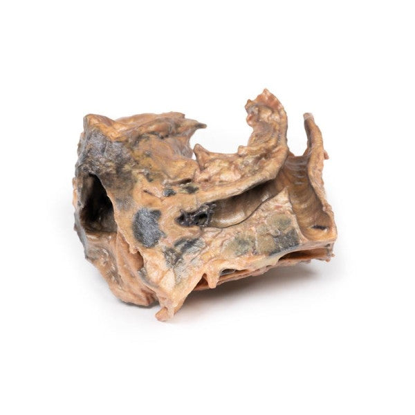 Inhaled Foreign Body Trachea 3D Printed Anatomy Model | Anatomical ...