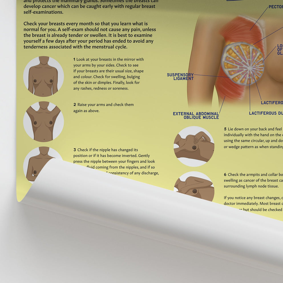 Breast Self Examination Poster | Breast Awareness Education Chart ...