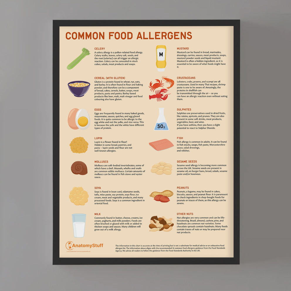 Common Food Allergens Poster | Allergy Awareness Chart | AnatomyStuff
