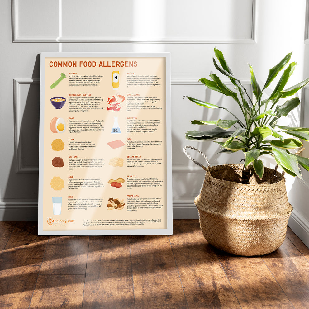 Common Food Allergens Poster | Allergy Awareness Chart | AnatomyStuff