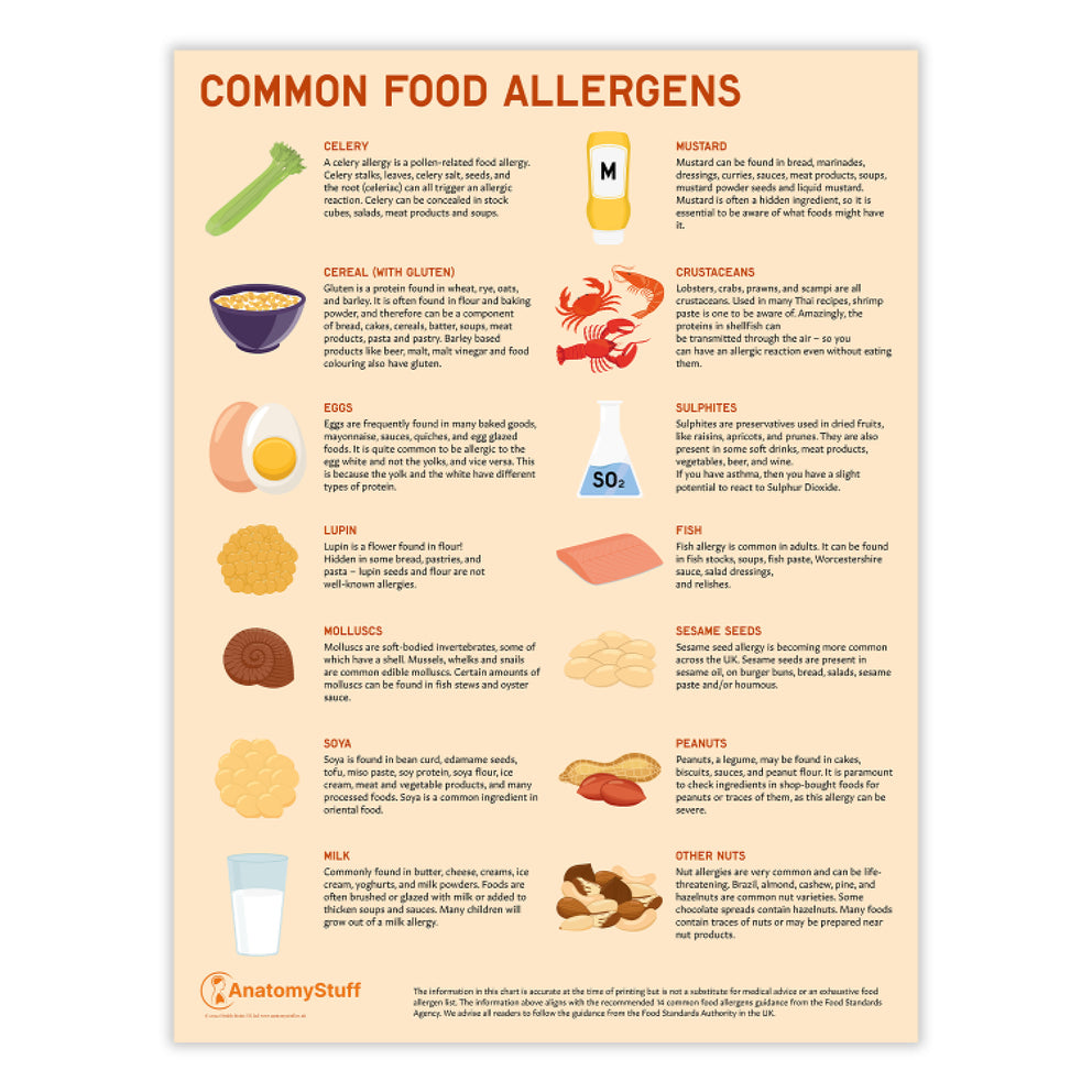 Common Food Allergens Poster | Allergy Awareness Chart | AnatomyStuff