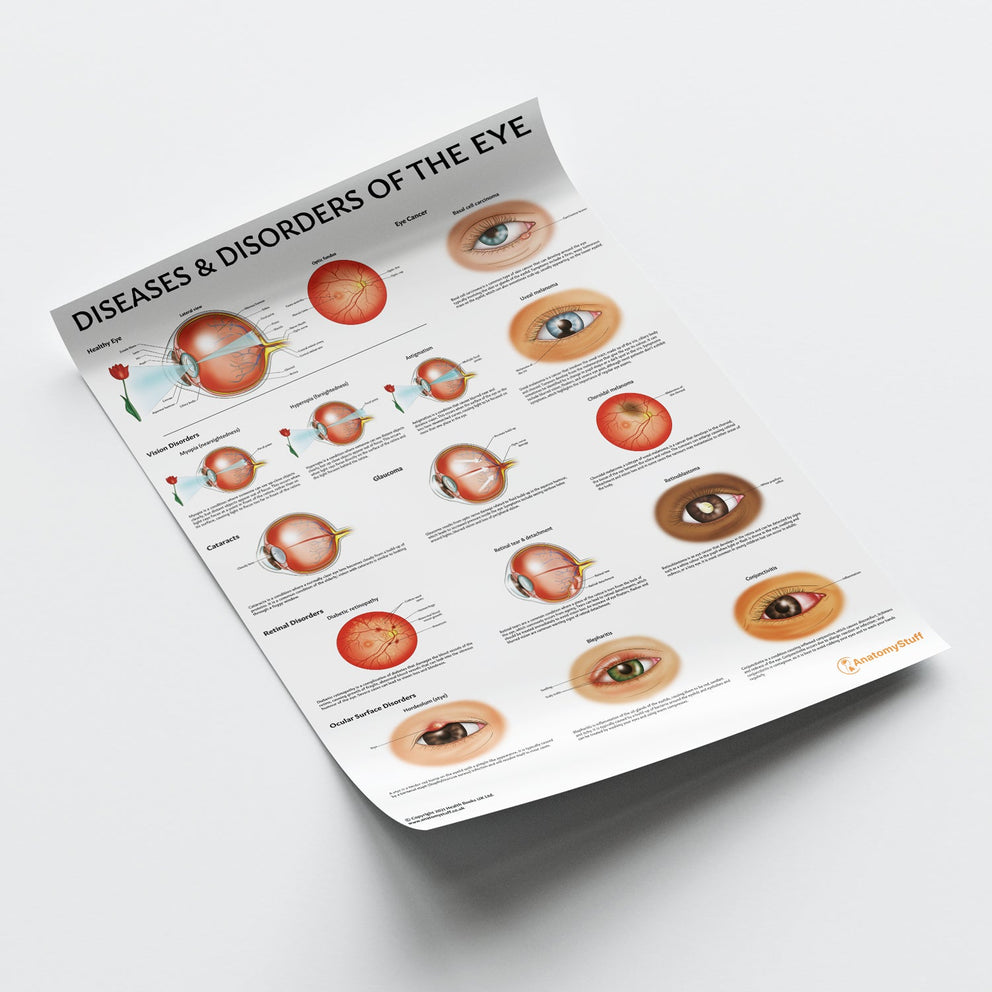 Diseases and Disorders of the Eye Poster | Eye Anatomy Chart – AnatomyStuff