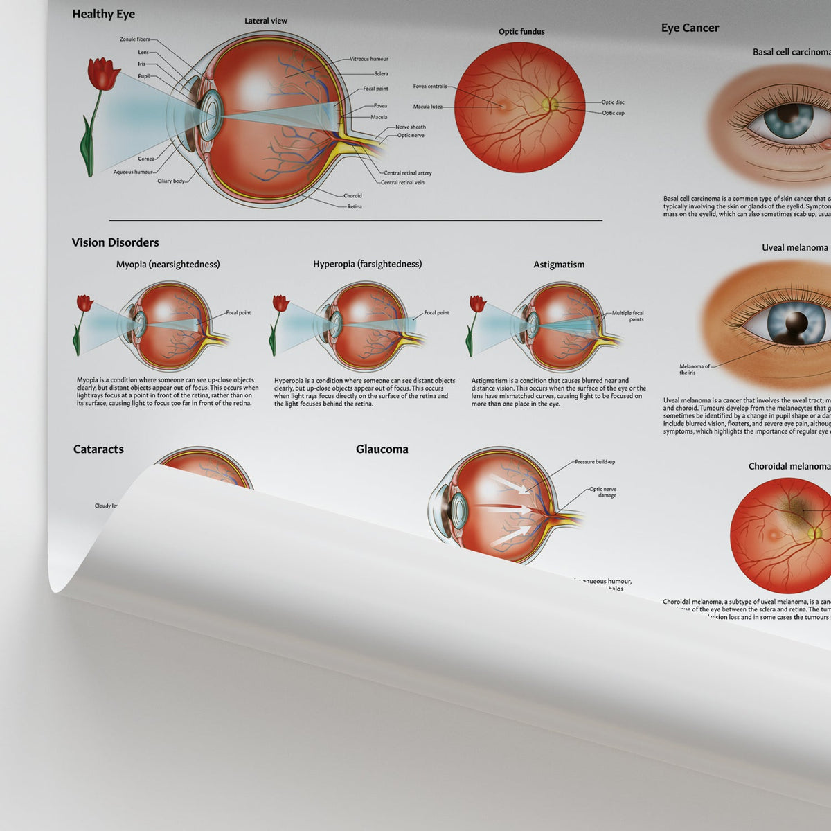 Diseases and Disorders of the Eye Poster | Eye Anatomy Chart – AnatomyStuff
