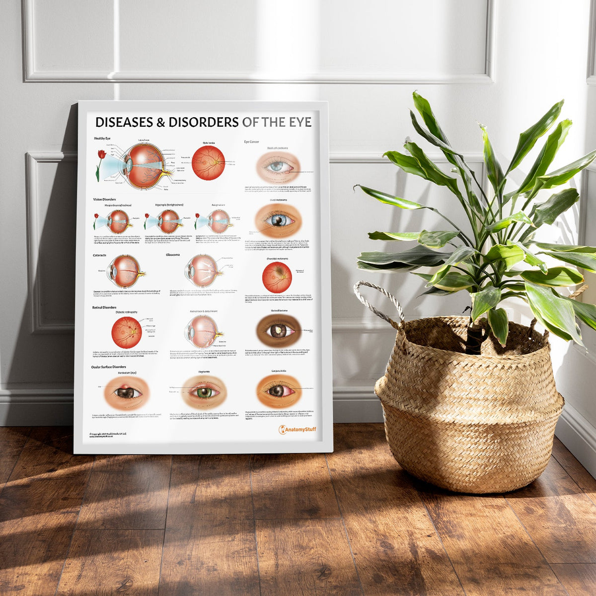 Diseases and Disorders of the Eye Poster | Eye Anatomy Chart – AnatomyStuff