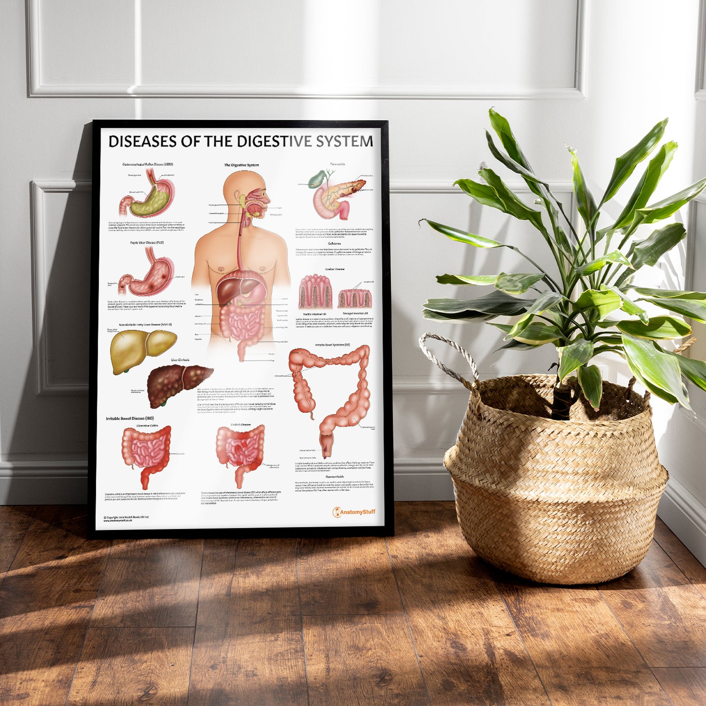 Diseases of the Digestive System Poster | Educational Anatomy Chart ...