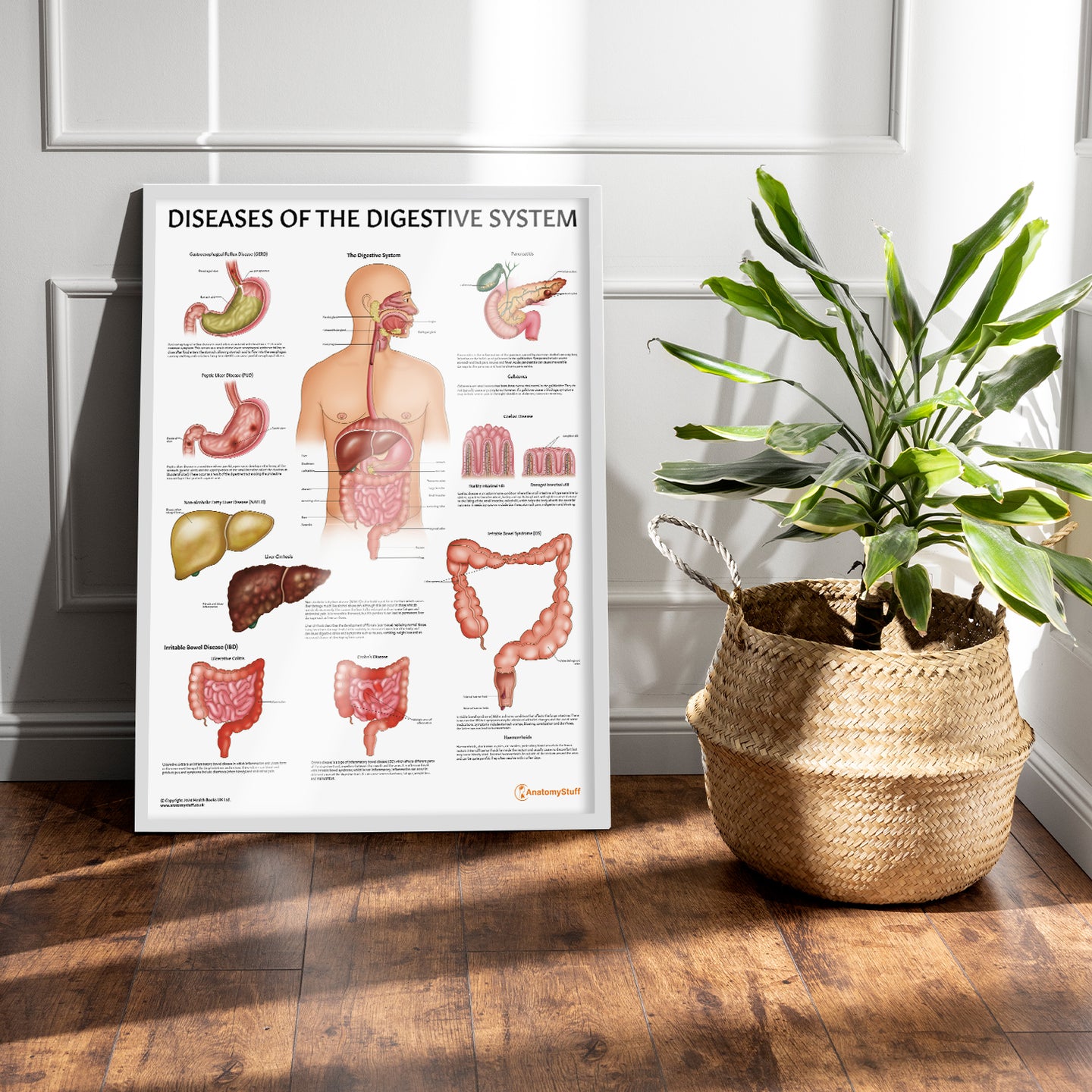Diseases of the Digestive System Poster | Educational Anatomy Chart ...