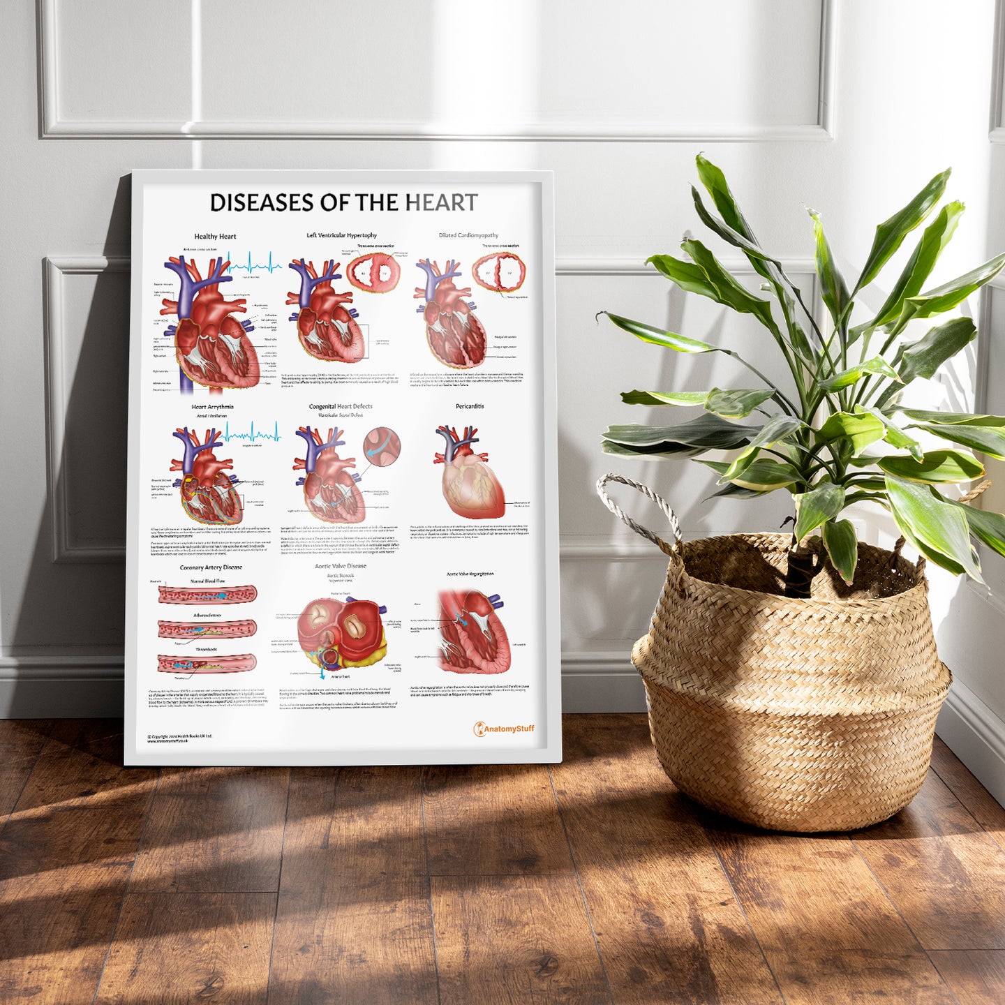 Diseases of the Heart Chart | Heart Conditions Poster | AnatomyStuff