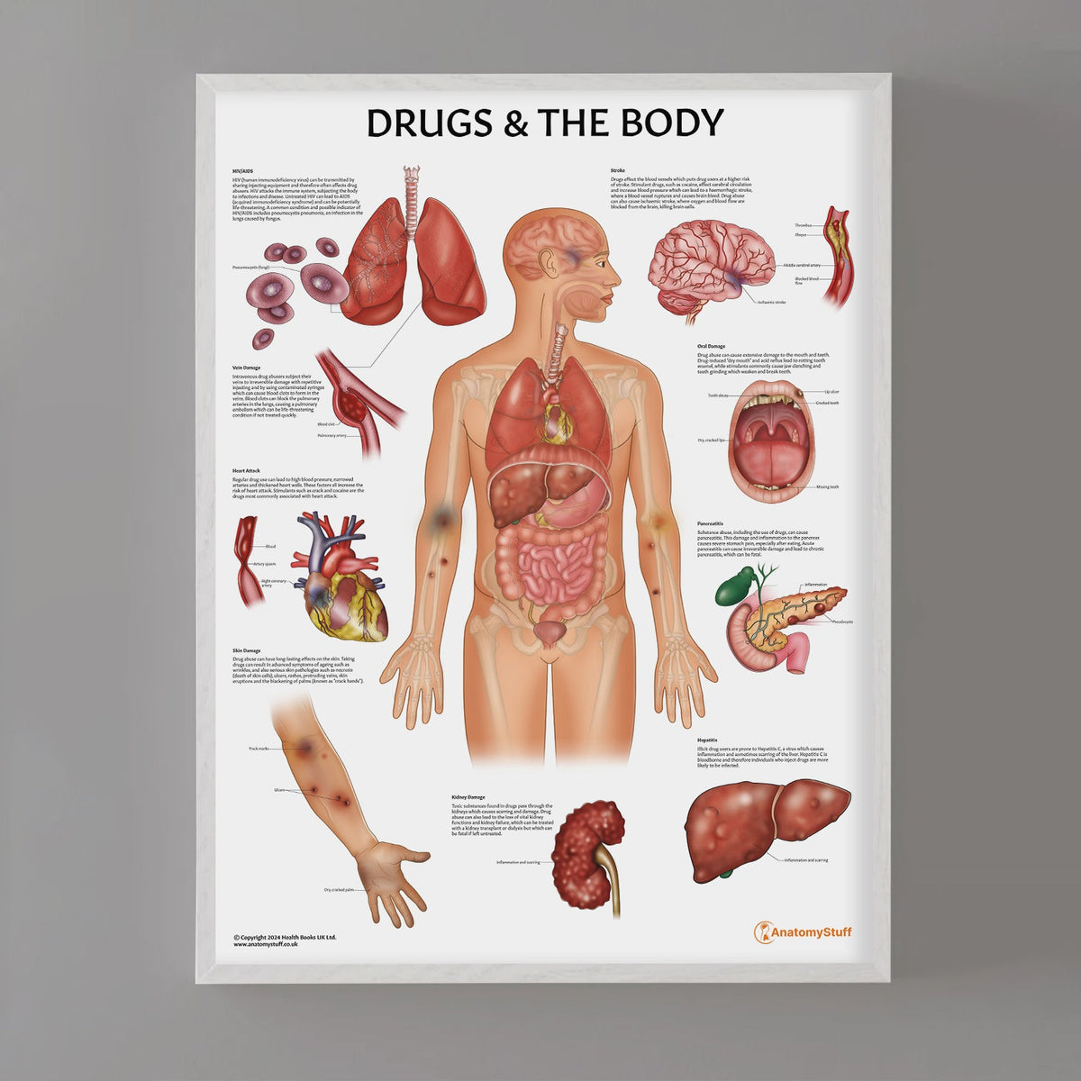 Effects of Drugs on the Human Body Poster | Drug Awareness Chart ...