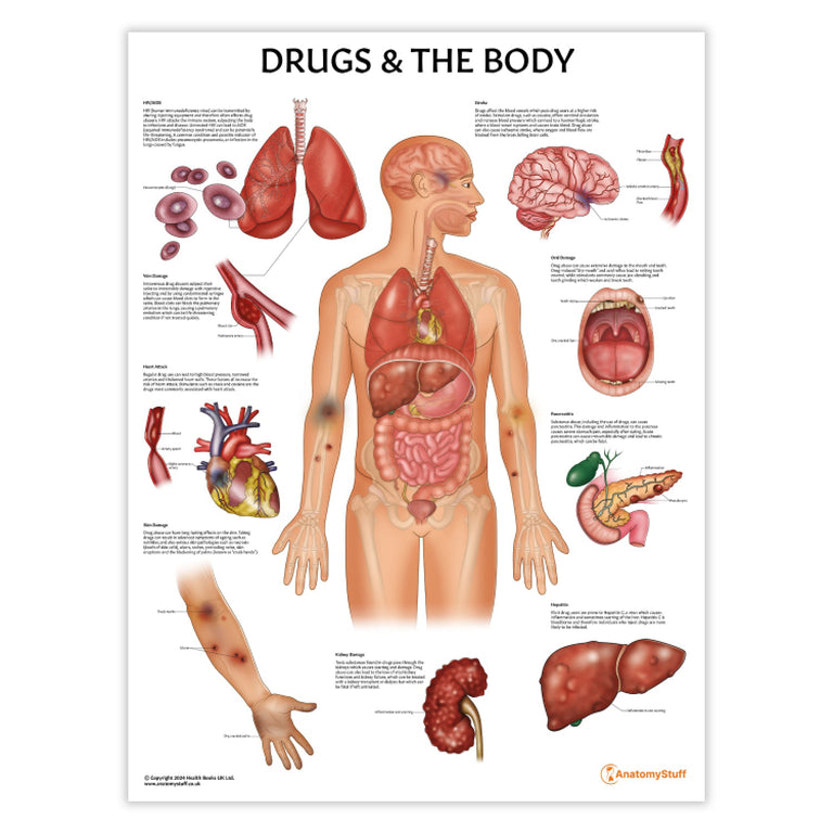 Effects of Drugs on the Human Body Poster | Drug Awareness Chart ...