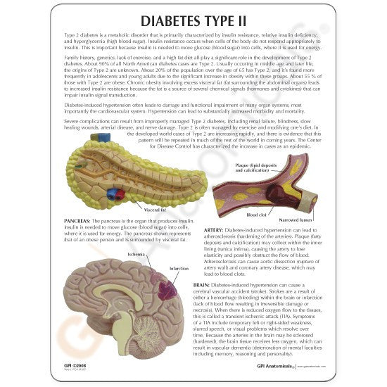 Type II Diabetes Model (8 part) 4010 | Diabetes Display | GPI ...