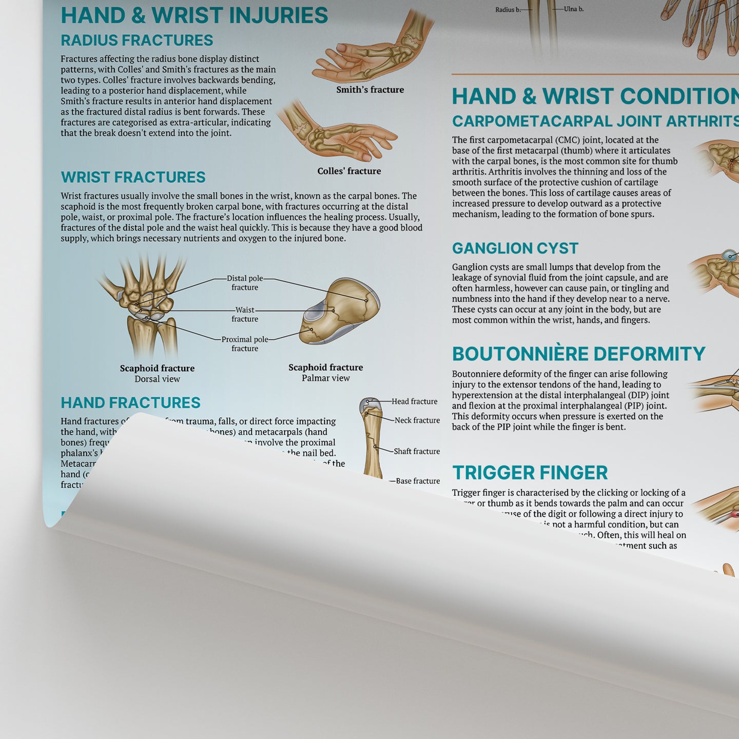 Injuries & Conditions of the Hand & Wrist Poster | Anatomy Chart ...