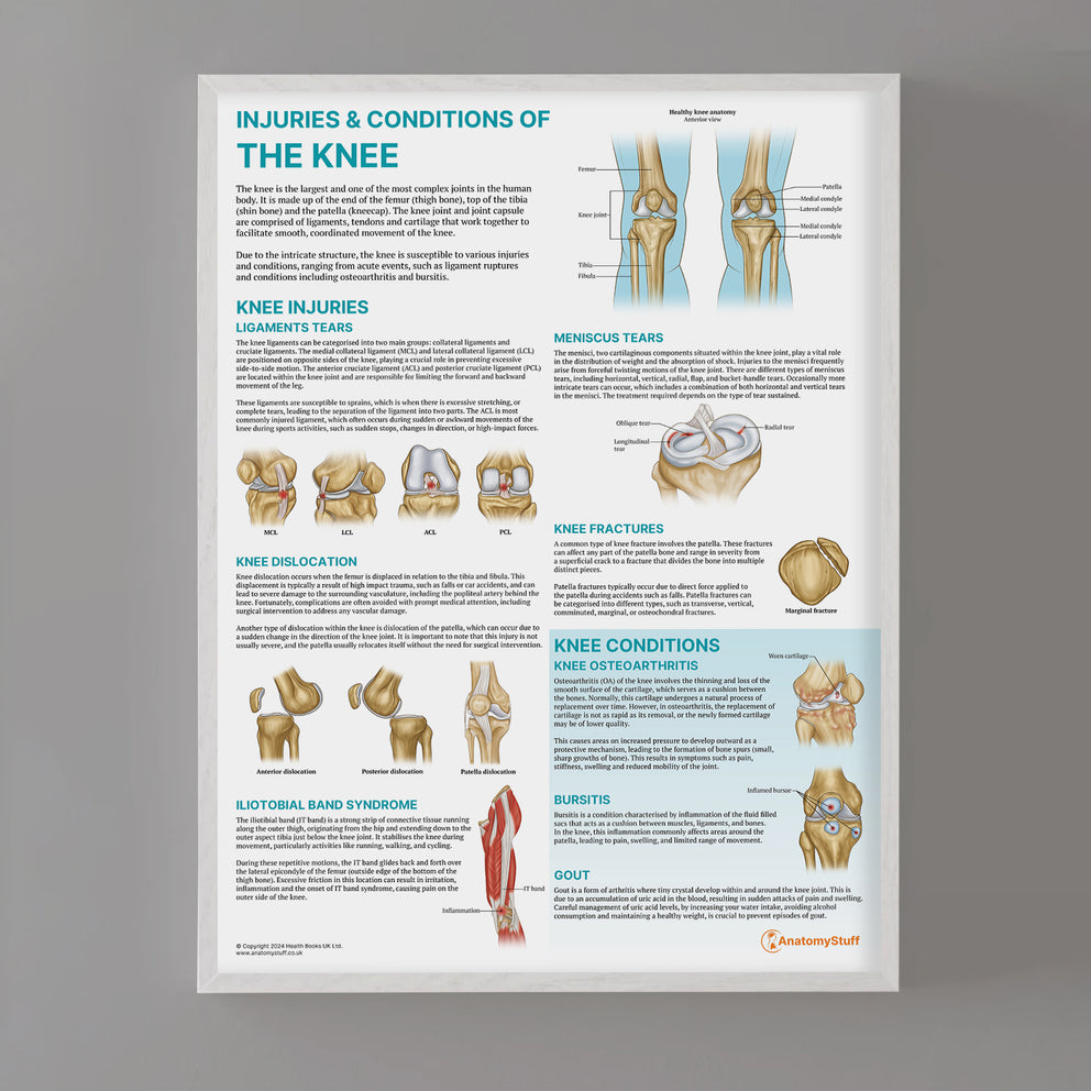 The Anatomy of the Knee Poster | Injuries & Conditions Chart – AnatomyStuff