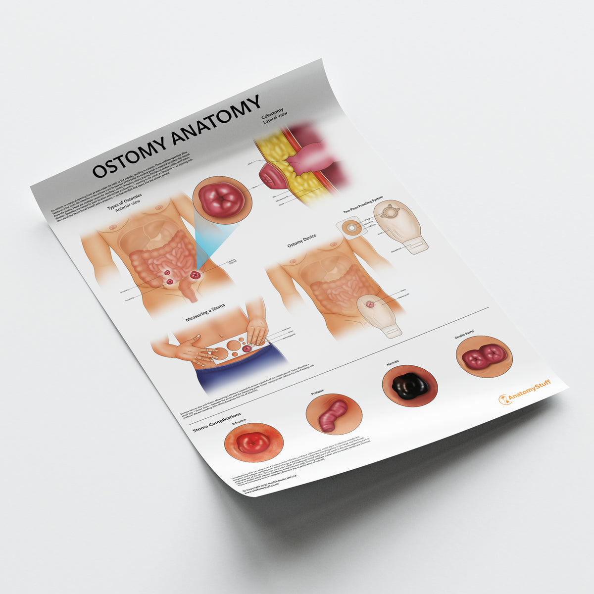 Ostomy Anatomy Poster | Digestive and Urological Stoma Chart – AnatomyStuff