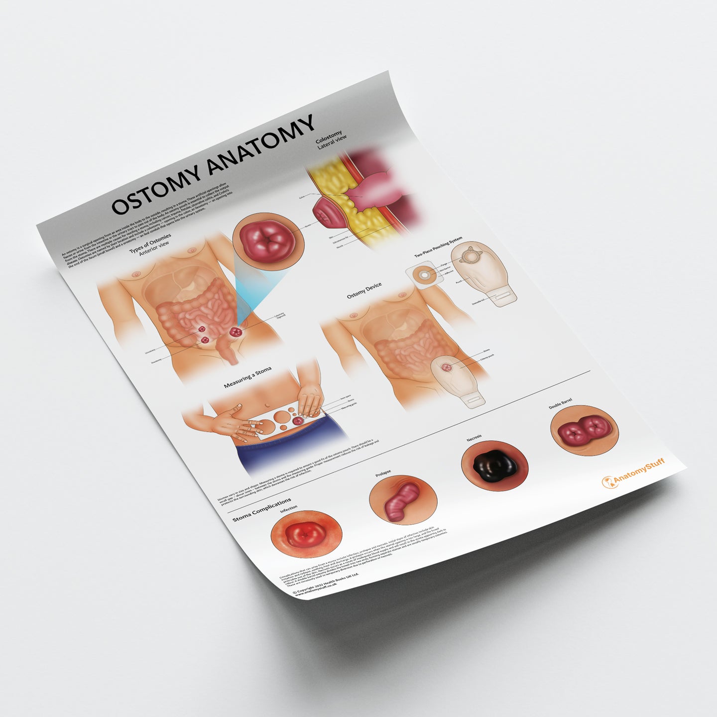 Ostomy Anatomy Poster | Digestive and Urological Stoma Chart – AnatomyStuff