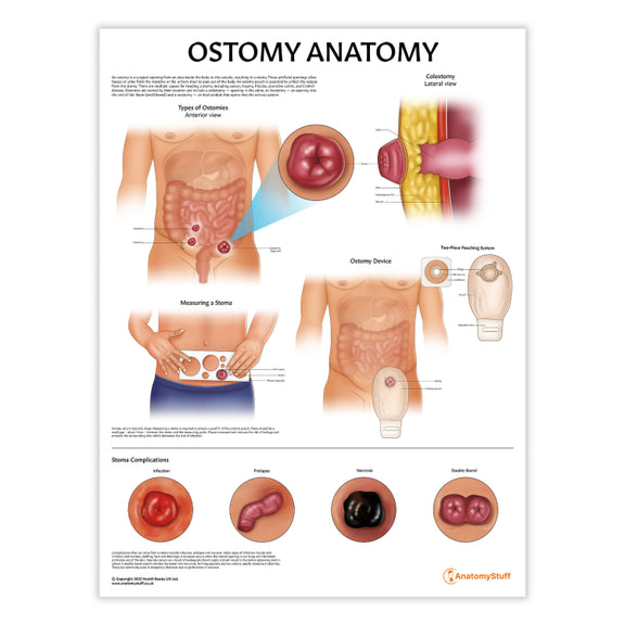Ostomy Anatomy Poster | Digestive and Urological Stoma Chart – AnatomyStuff