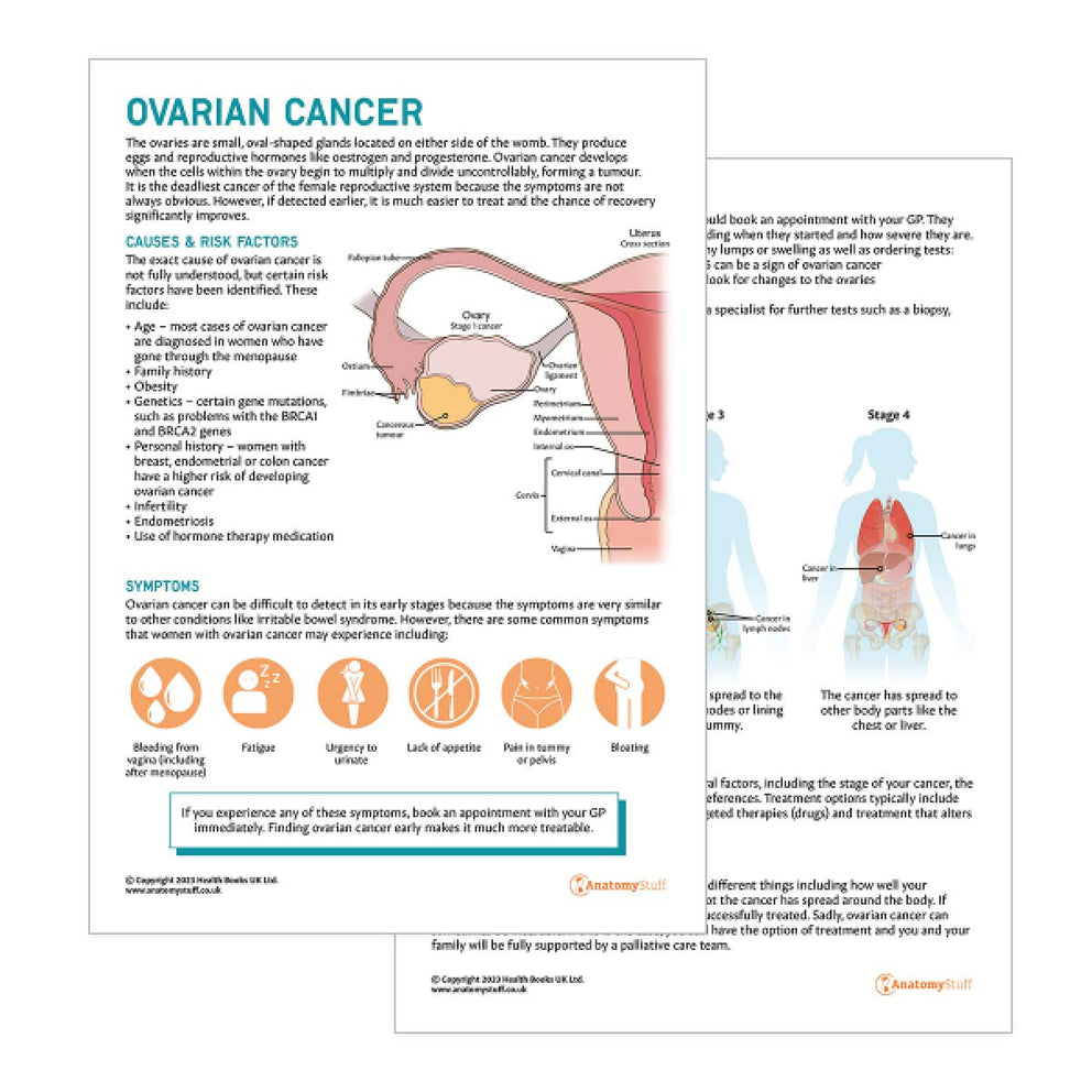 Printable Ovarian Cancer PDF | Patient Education Leaflet | AnatomyStuff