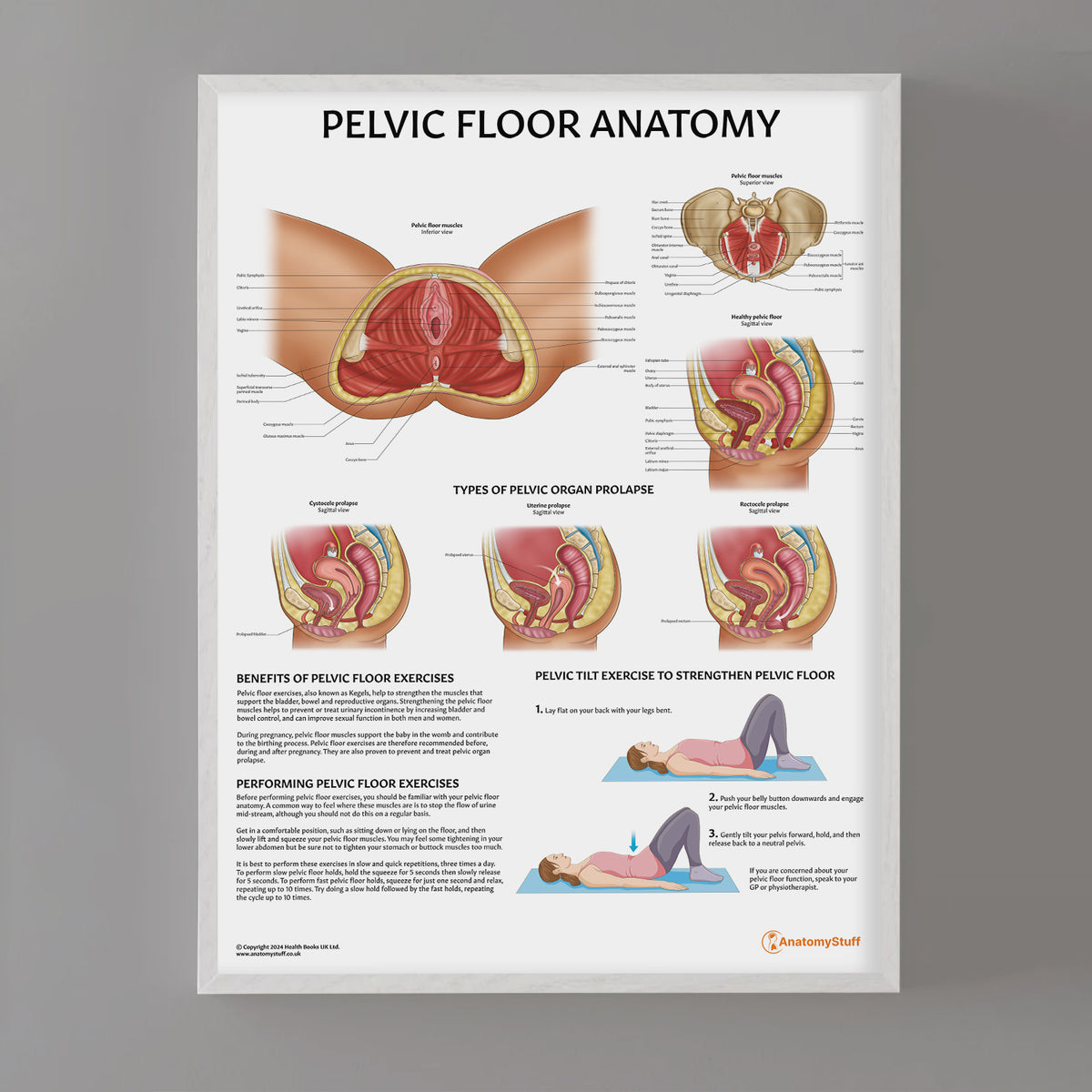 Pelvic Floor Anatomy Poster | Women's Health & Prolapse Chart – AnatomyStuff