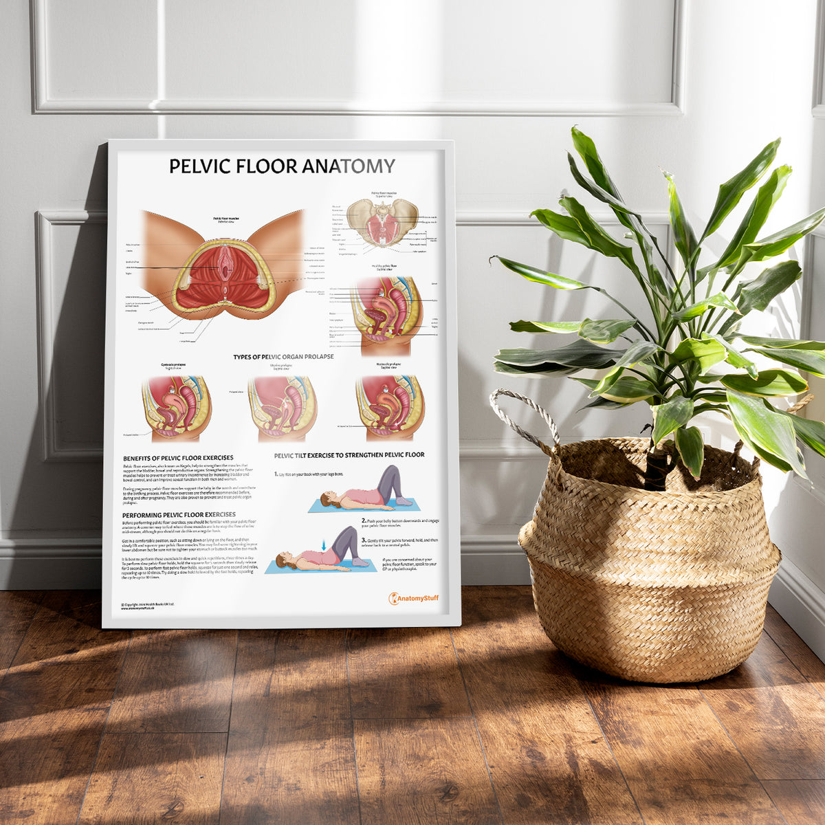 Pelvic Floor Anatomy Poster | Women's Health & Prolapse Chart ...