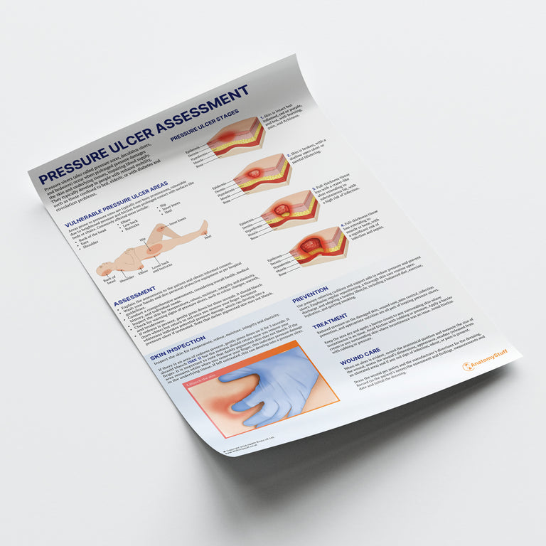 Pressure Ulcer Assessment Poster | Wound Care Education Chart ...