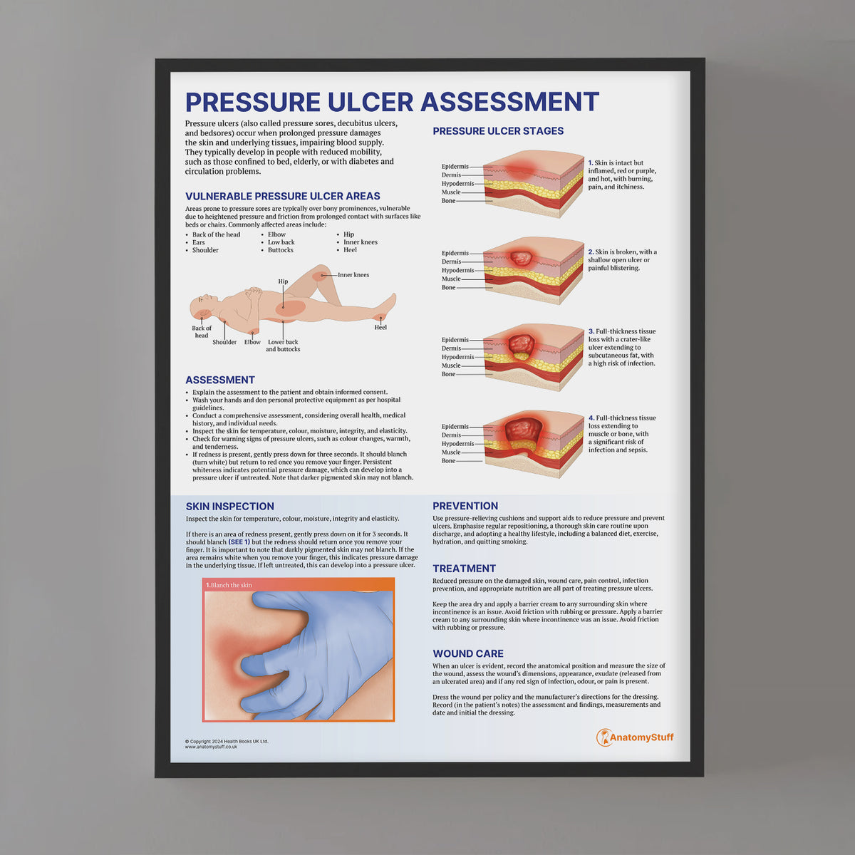 Pressure Ulcer Assessment Poster | Wound Care Education Chart ...
