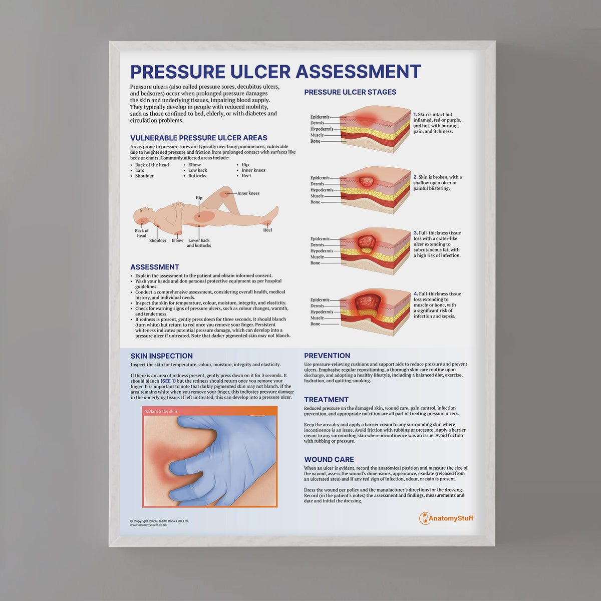 Pressure Ulcer Assessment Poster | Wound Care Education Chart ...