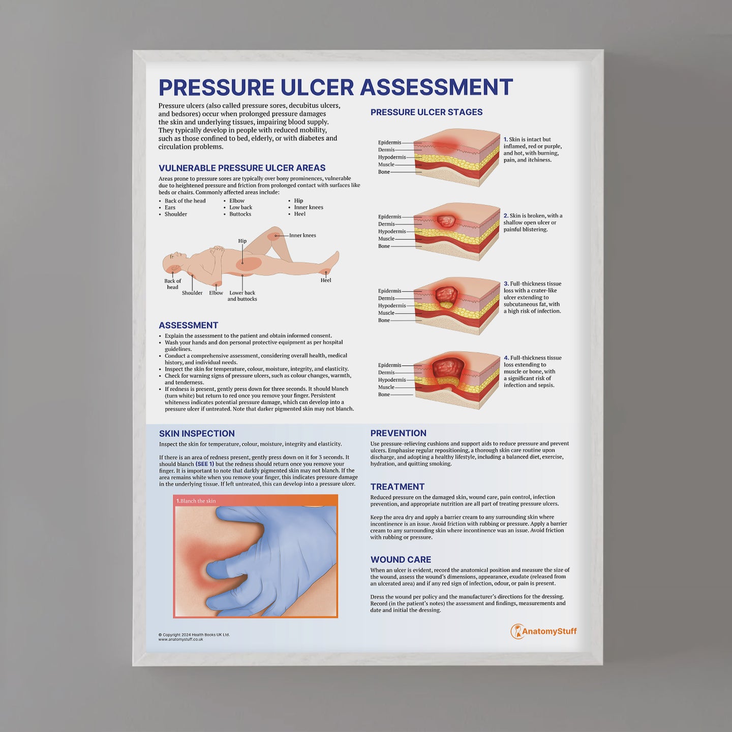Pressure Ulcer Assessment Poster | Wound Care Education Chart ...