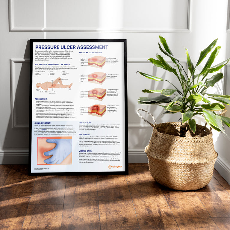 Pressure Ulcer Assessment Poster | Wound Care Education Chart ...