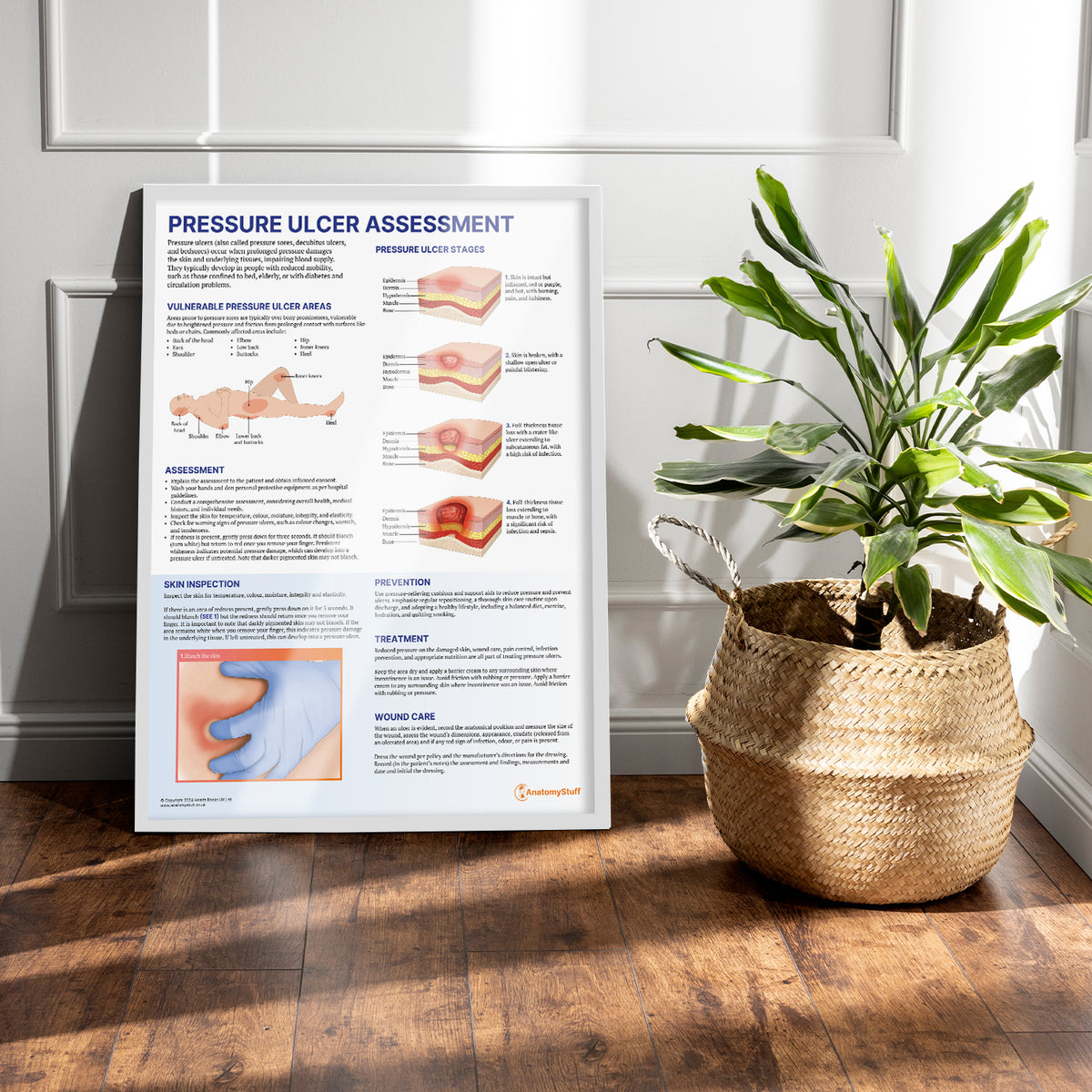 Pressure Ulcer Assessment Poster | Wound Care Education Chart ...