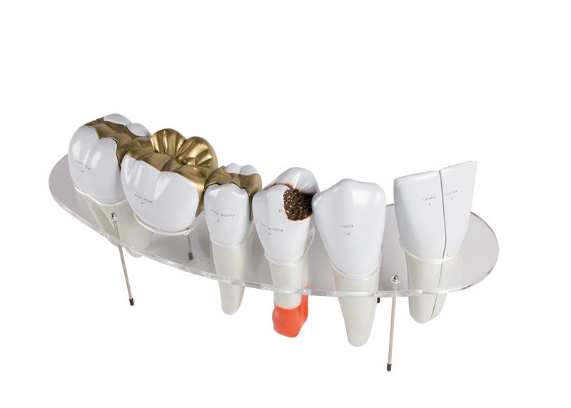 Dental Morphology Series by Denoyer Geppert | Giant Teeth Models ...