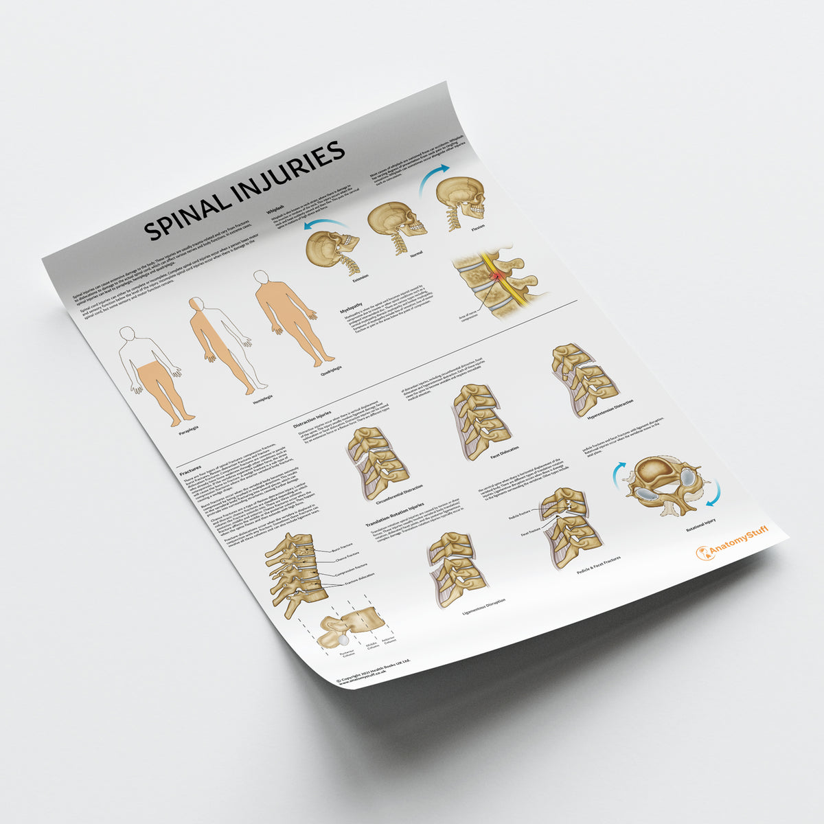 Spinal Injuries Poster | Spine Injury Education Chart – AnatomyStuff