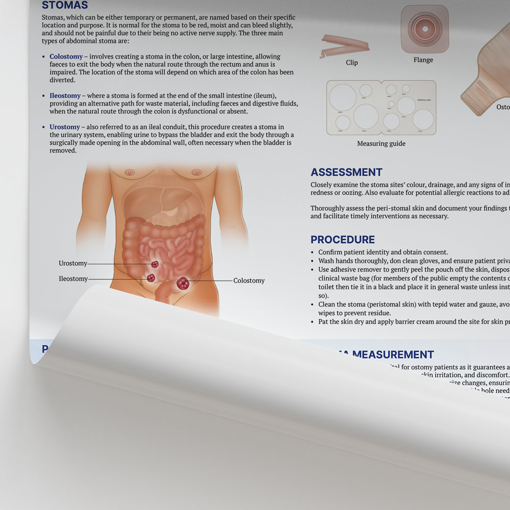 Stoma Care Poster | Ostomy Assessment and Patient Support Chart ...