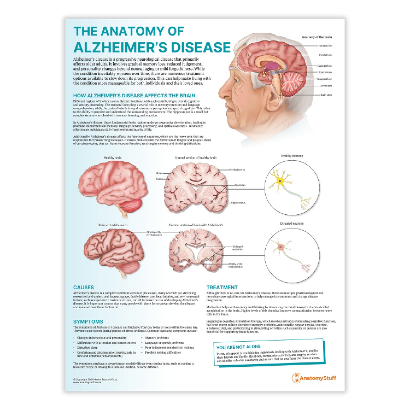 The Anatomy of Alzheimer's Disease Chart | Brain Health Poster ...