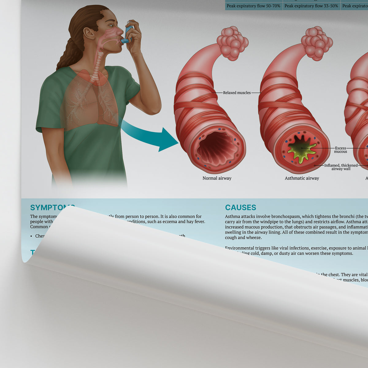 The Anatomy of Asthma Chart | Respiratory Poster – AnatomyStuff