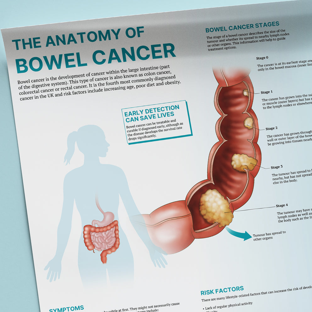 Women's Cancer – AnatomyStuff