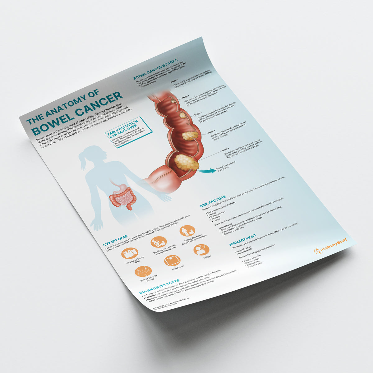 The Anatomy of Bowel Cancer Chart | Gastroenterology Poster – AnatomyStuff