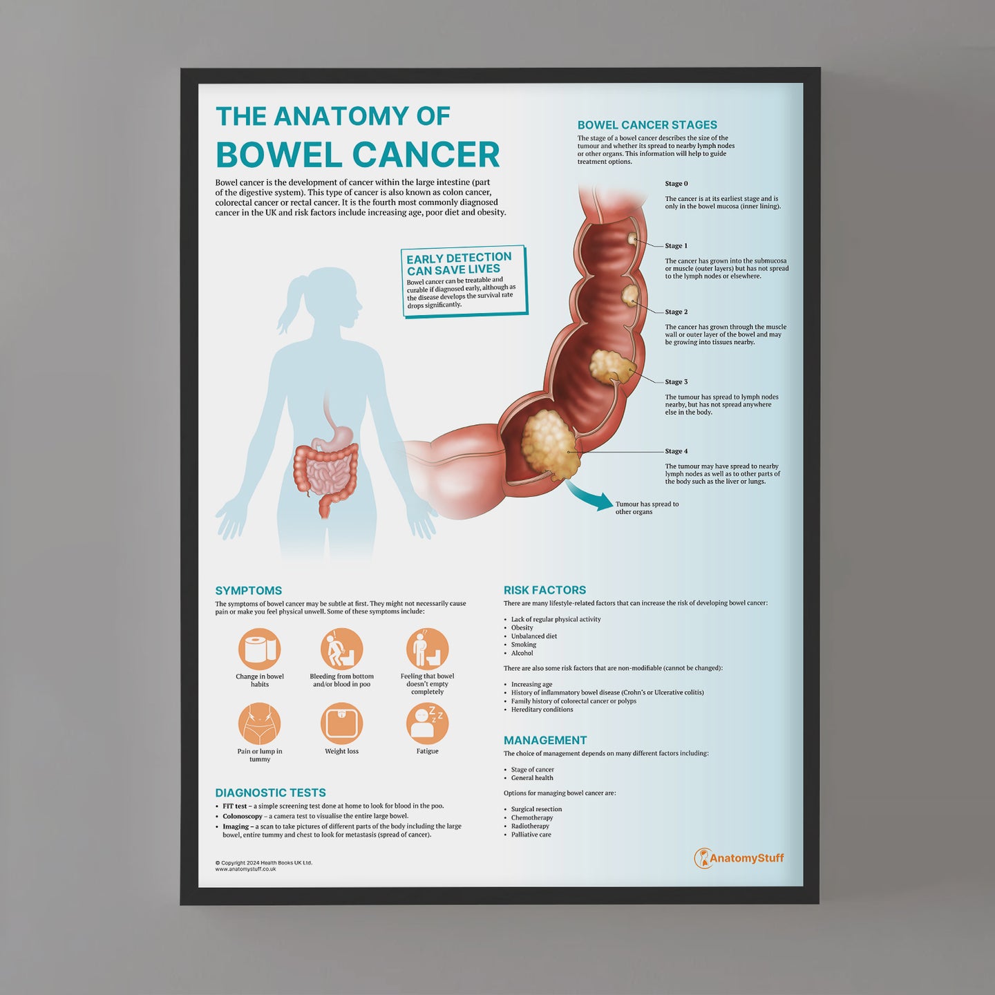 The Anatomy of Bowel Cancer Chart | Gastroenterology Poster – AnatomyStuff