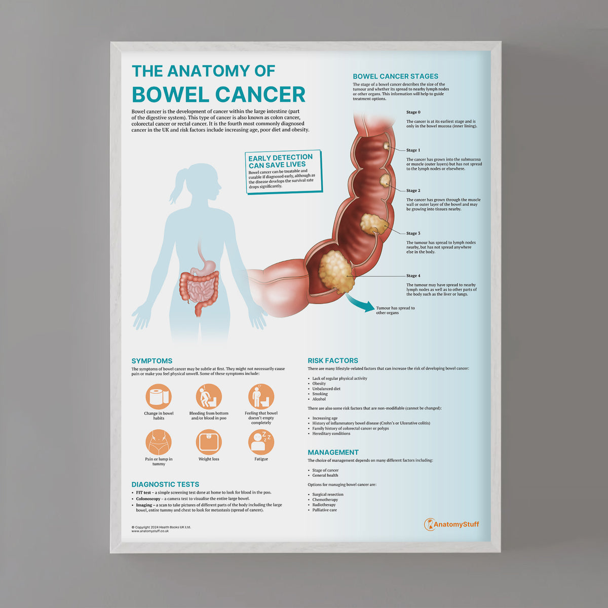 The Anatomy of Bowel Cancer Chart | Gastroenterology Poster – AnatomyStuff