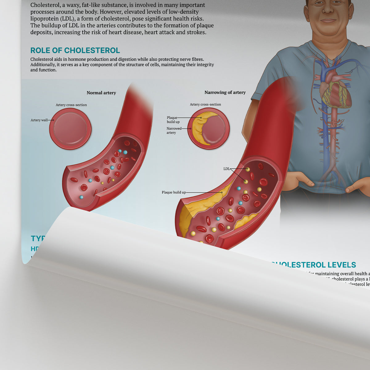 Cholesterol Anatomy Poster | Heart Health & LDL vs HDL Chart – AnatomyStuff