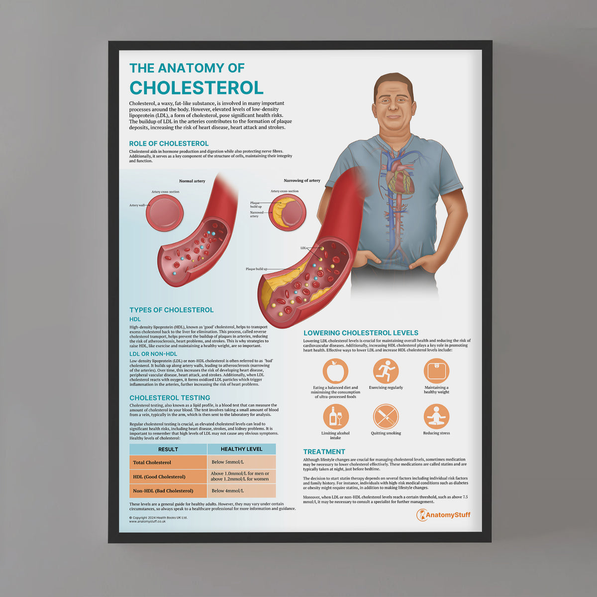 Cholesterol Anatomy Poster | Heart Health & LDL vs HDL Chart – AnatomyStuff