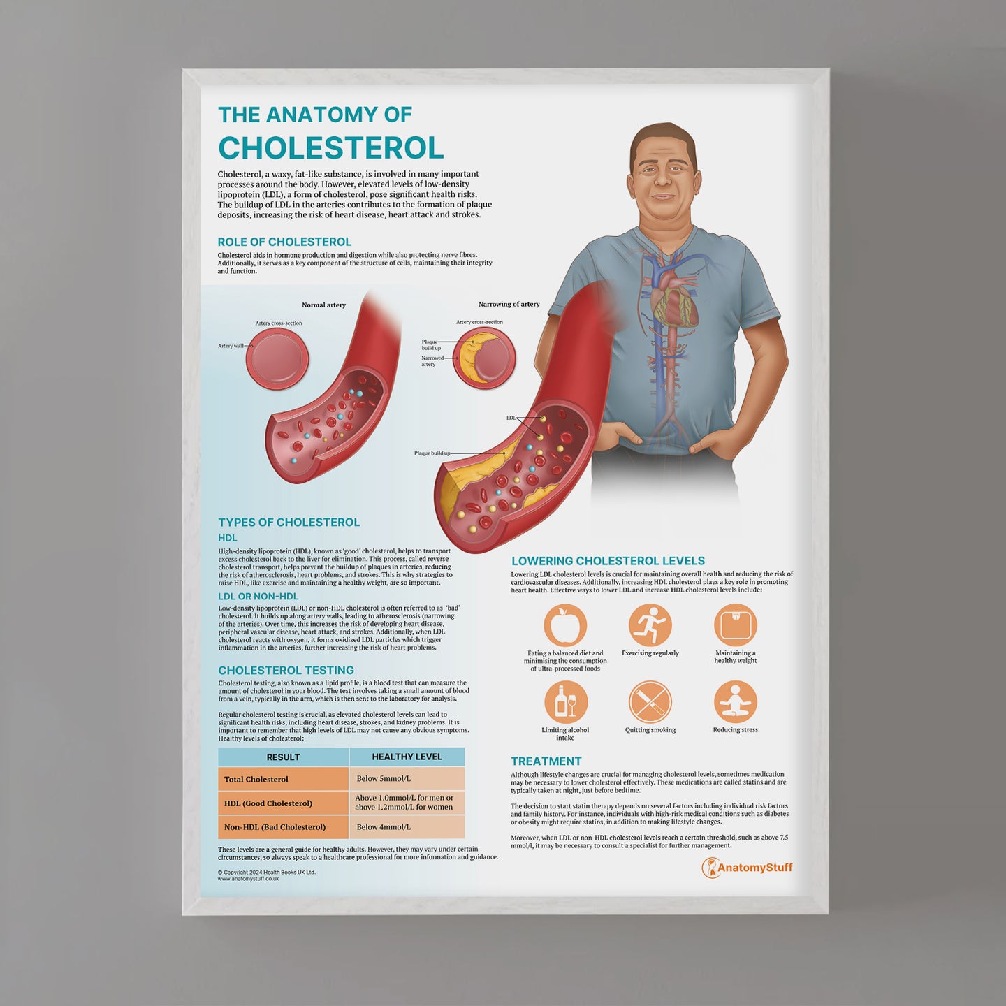 Cholesterol Anatomy Poster | Heart Health & LDL vs HDL Chart – AnatomyStuff