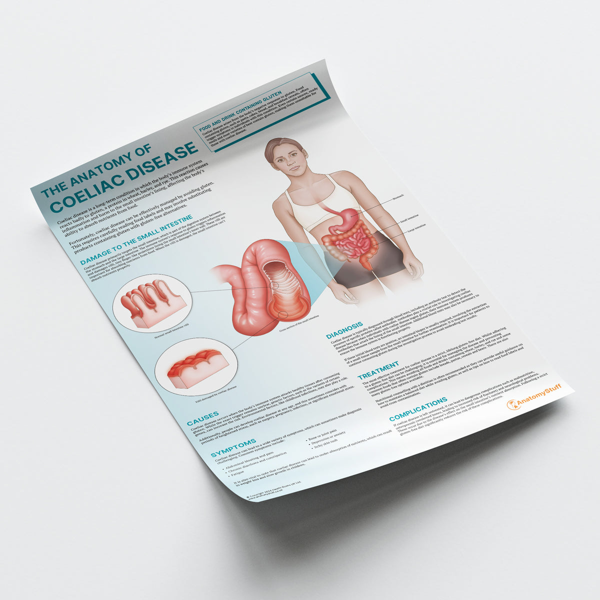 The Anatomy of Coeliac Disease Chart | Digestive Health Poster ...