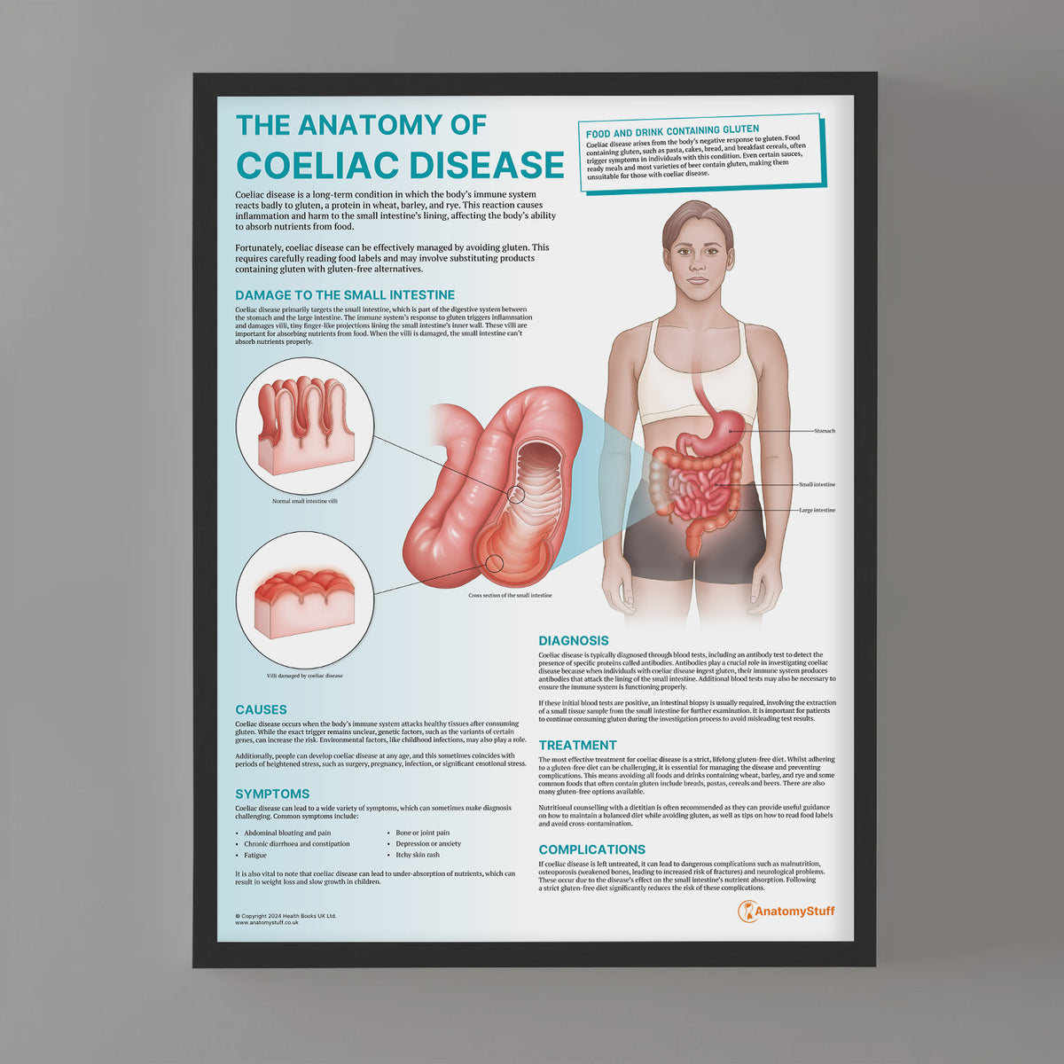 The Anatomy of Coeliac Disease Chart | Digestive Health Poster ...