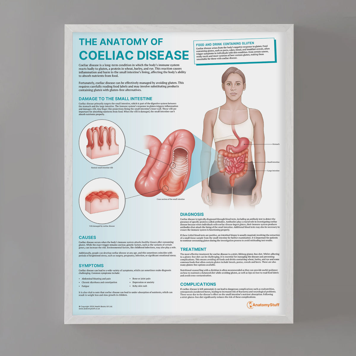 The Anatomy of Coeliac Disease Chart | Digestive Health Poster ...